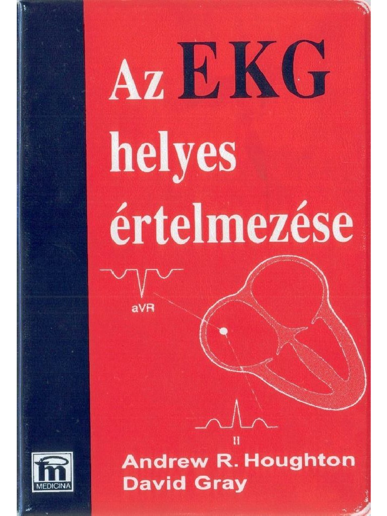 David Gray: Az EKG Helyes Értelmezése | PDF