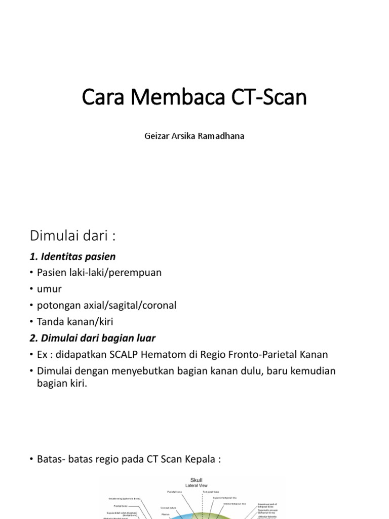 Panduan Membaca Hasil CT-Scan Kepala | PDF