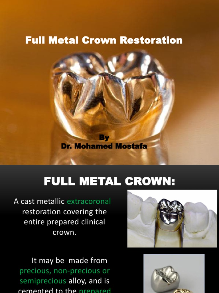 Full Metal Crown Prep. | PDF | Human Tooth | Mouth