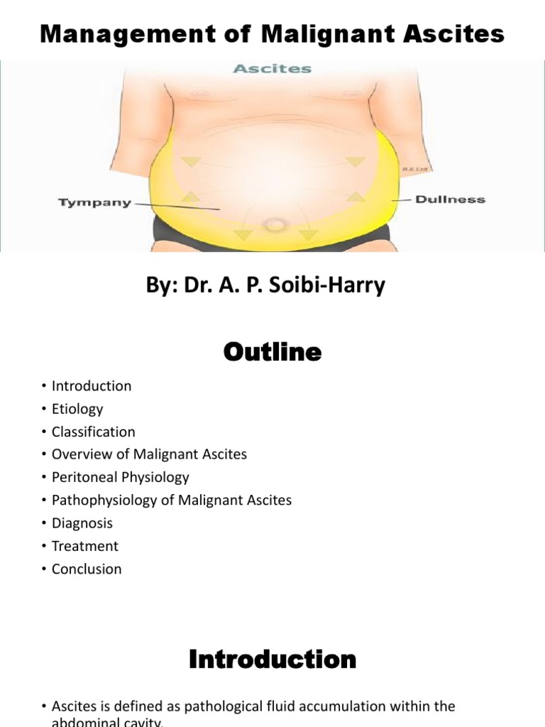 Management of Malignant Ascites | PDF | Ovarian Cancer | Cancer
