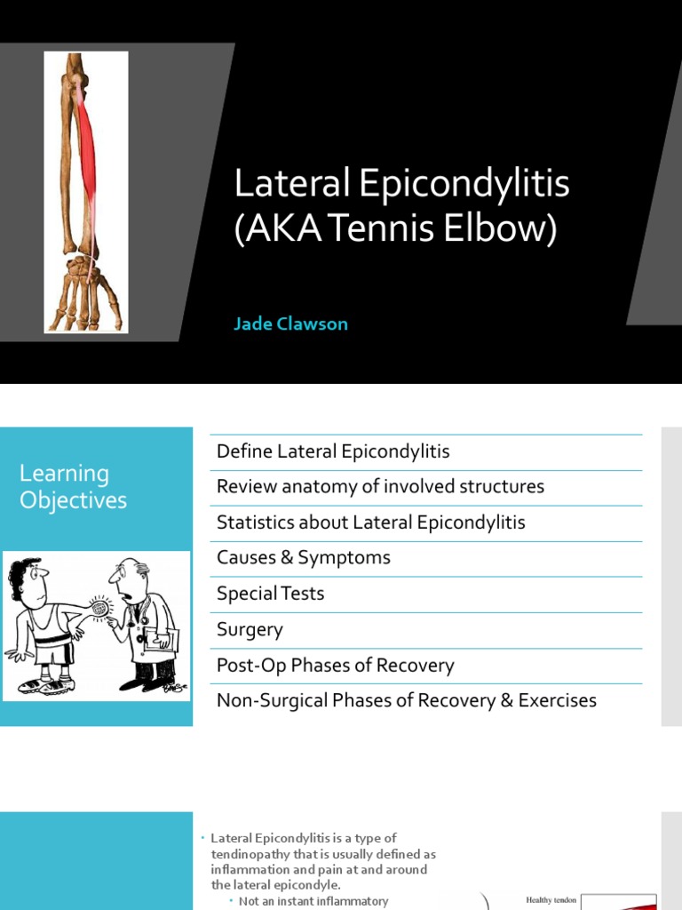 Lateral Epicondylitis Presentation | PDF | Elbow | Human Anatomy