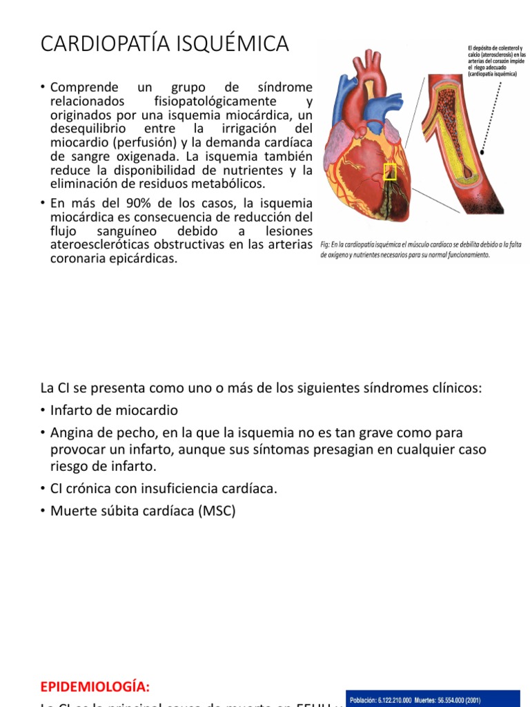 Cardiopatía Isquémica: Causas y Consecuencias | PDF | Infarto de ...