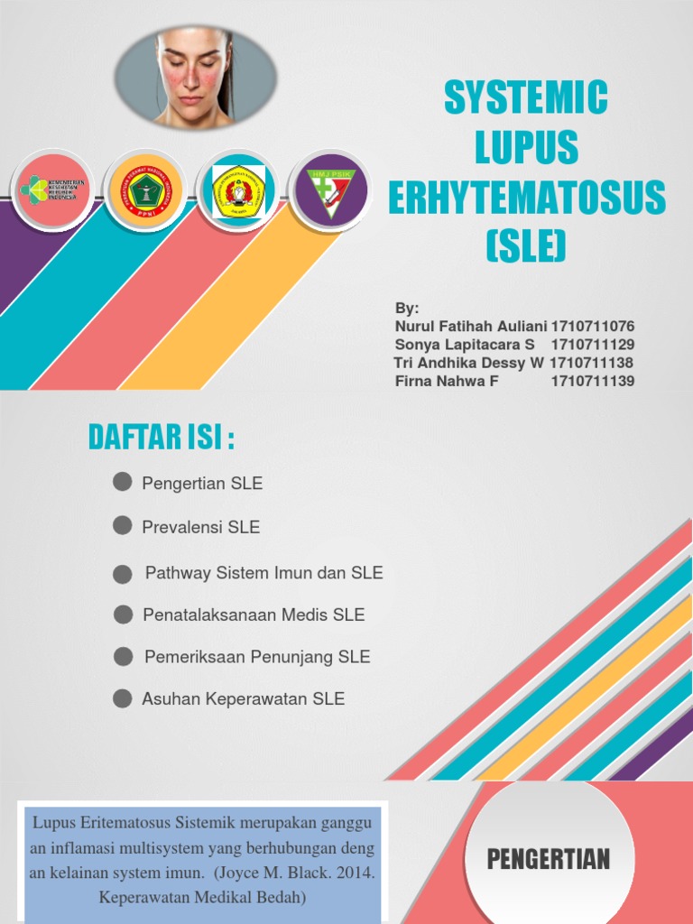 Penatalaksanaan Lupus Eritematosus Sistemik | PDF | Kesehatan Holistik