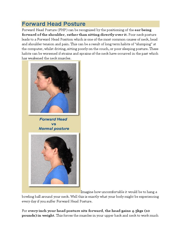 Correcting Forward Head Posture | PDF