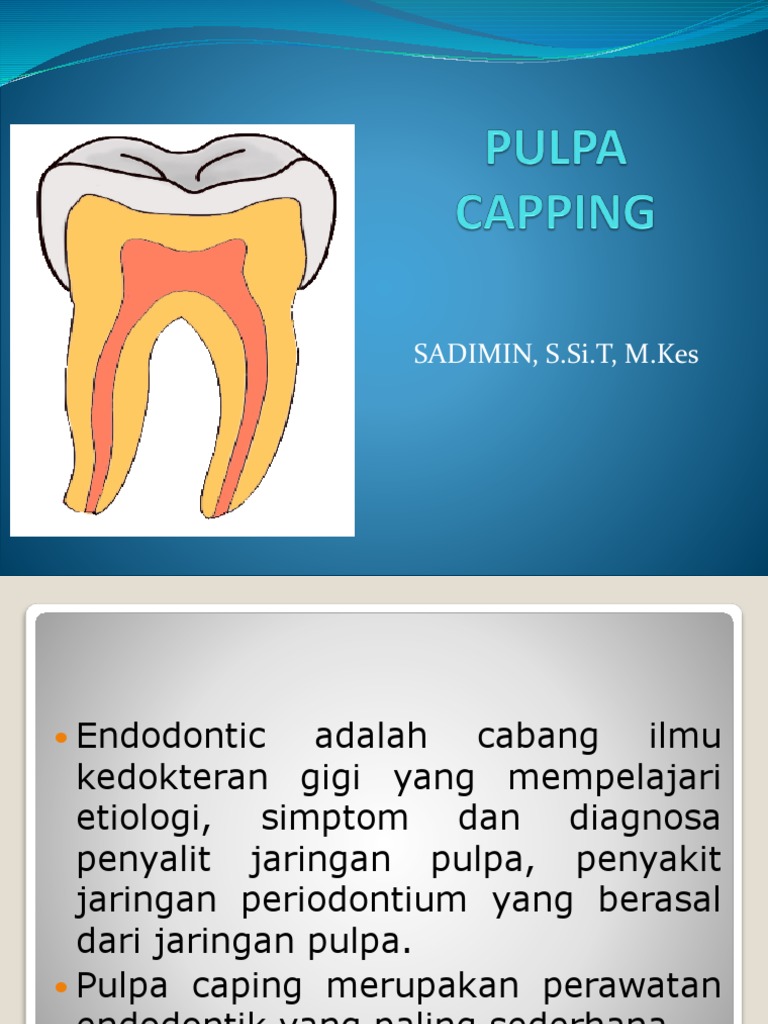 Pulpa Capping | PDF | Kajian Bahasa Asing | Kesehatan Holistik