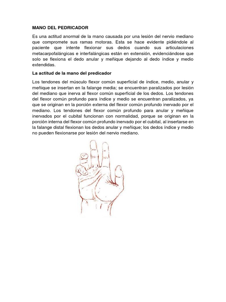 Lesión del Nervio Mediano en Mano | PDF | Hogar, jardinería y bricolaje