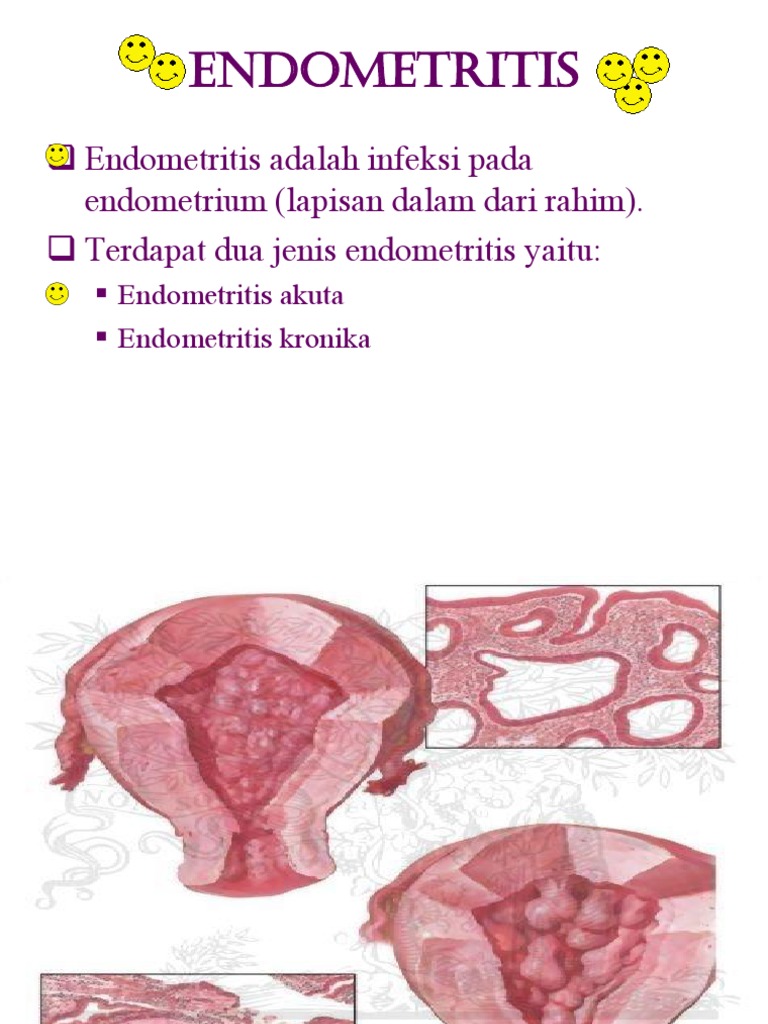 Endometritis | PDF