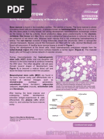 DVT Concept Map-1 | PDF | Thrombus | Bleeding