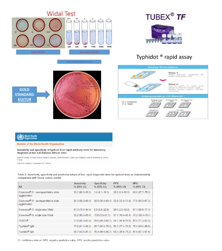 Typhoid Test | PDF