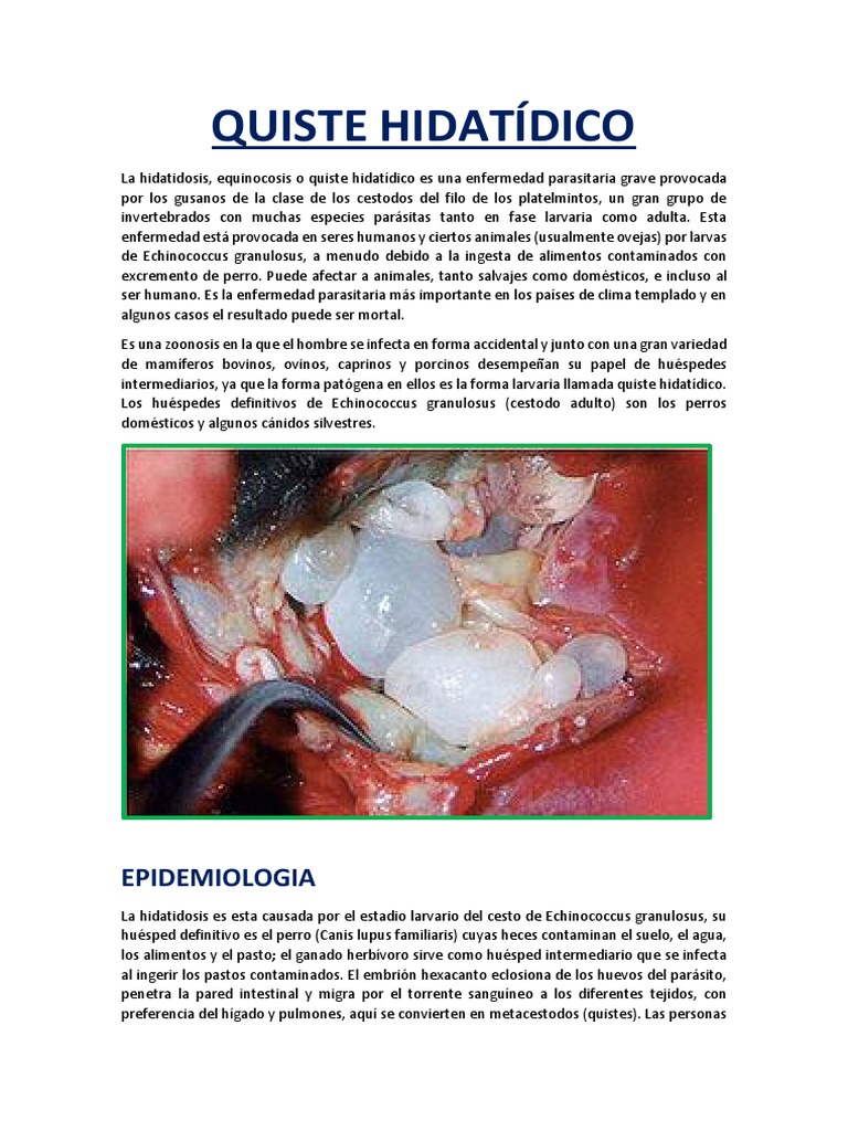 Hidatidosis: Quistes y Transmisión | PDF | Perros | Especialidades Medicas