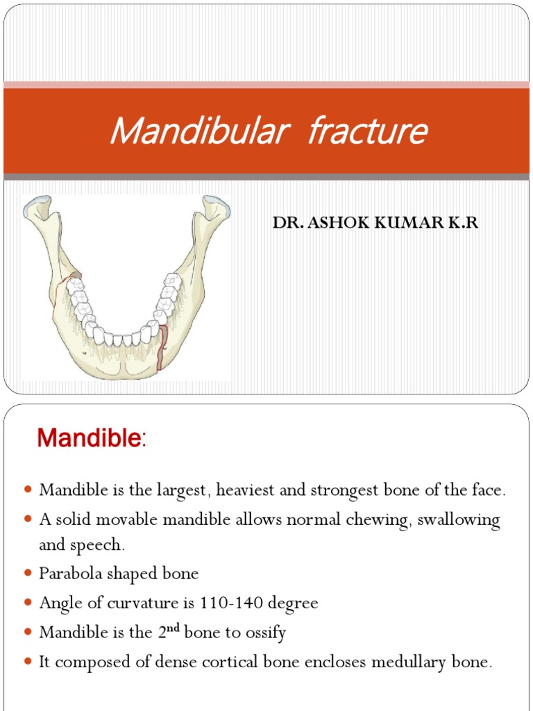 Mandible Fracture Classification