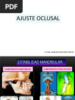 Técnica de Arco Segmentado Burstone | PDF | Diente | Odontología
