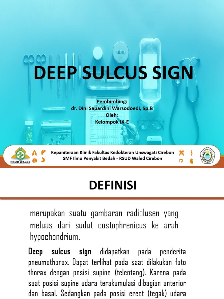 Deep Sulcus Sign | PDF