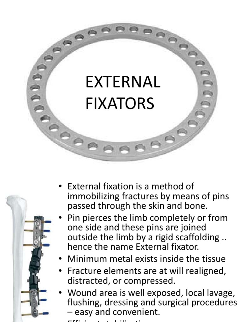 External Fixators | PDF | Screw | Musculoskeletal System