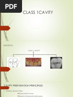 Class V. Cavity Preparation | PDF | Tooth Enamel | Mouth