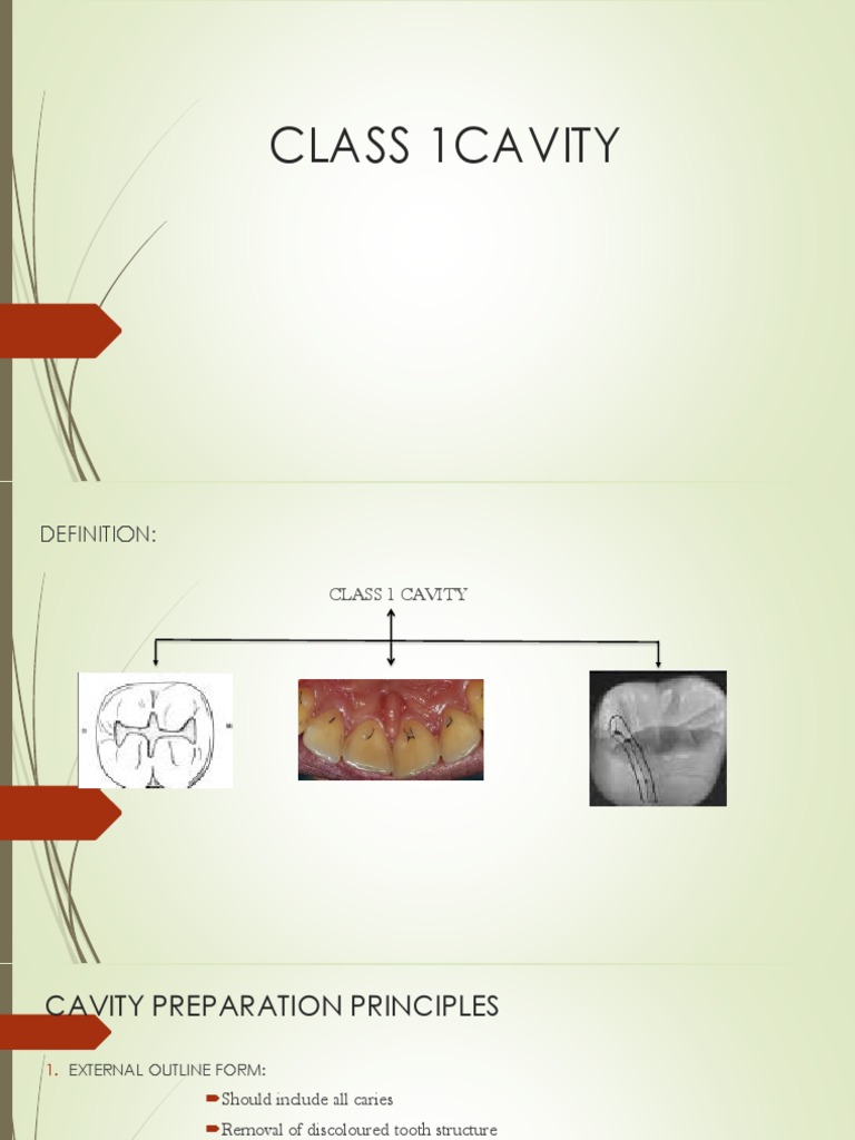 Principles of Class I Cavity Preparation and Selection of Appropriate ...