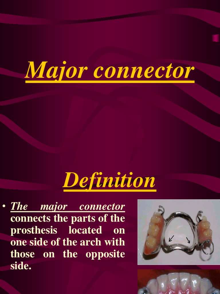 15 - Major and Minor Connector | PDF | Mouth | Dentistry Branches