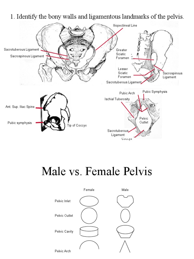 Identify The Bony Walls and Ligamentous Landmarks of The Pelvis | PDF ...