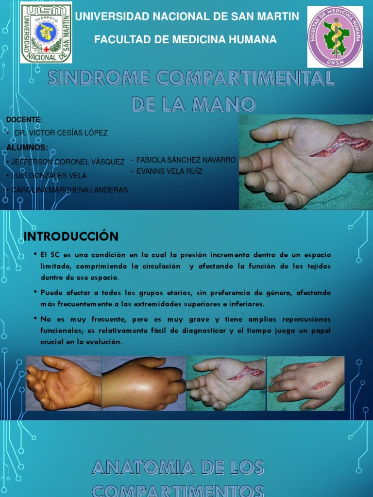 Sindrome Compartimental Diapo | PDF | Mano | Medicina CLINICA