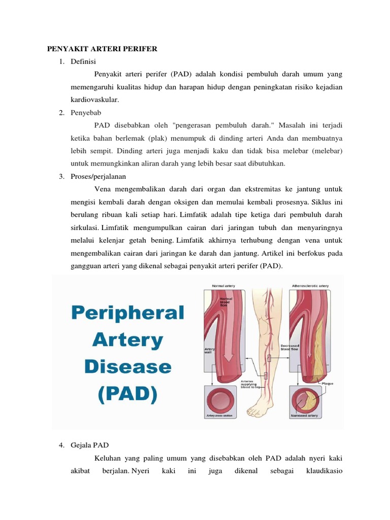 Penyakit Arteri Perifer | PDF