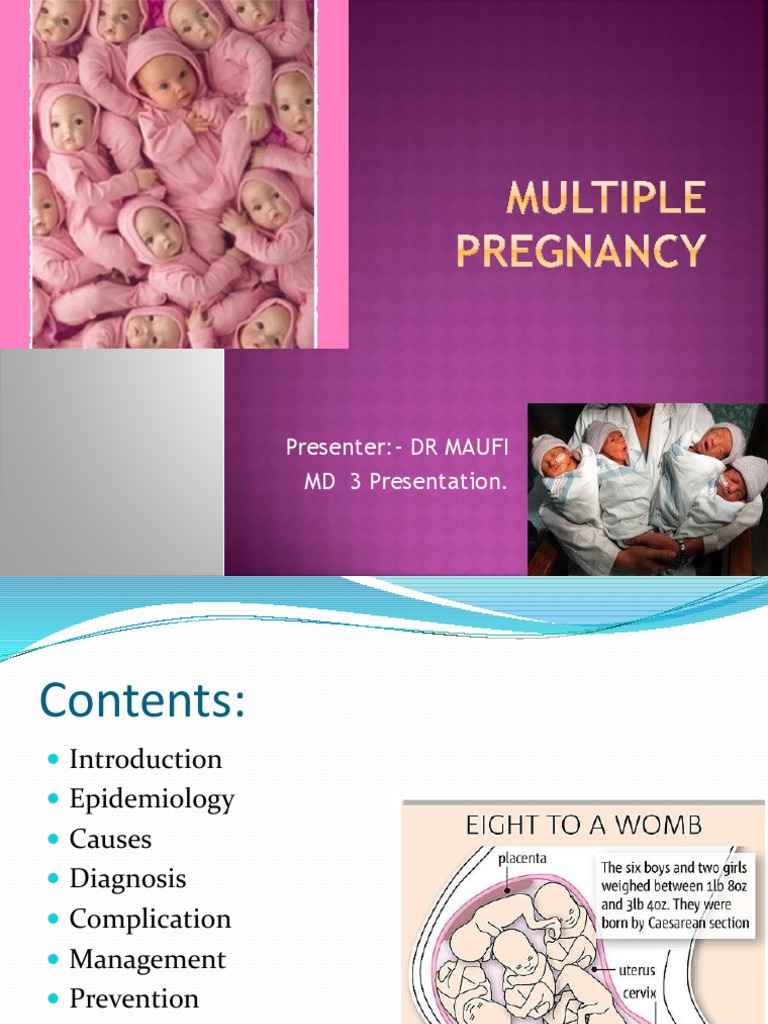 Multiple Pregnancy - PPTX Md3 | PDF | Multiple Births | Twin