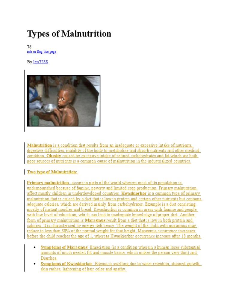 Types of Malnutrition | Download Free PDF | Malnutrition | Micronutrient