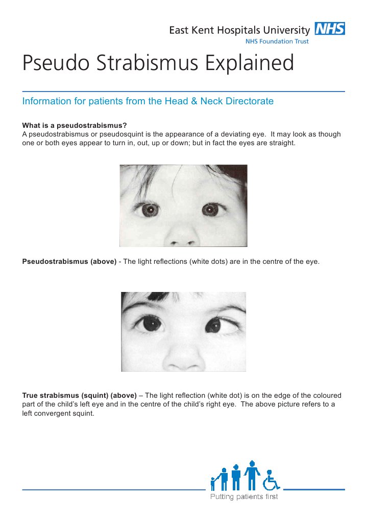 Explaining Pseudostrabismus: A Guide for Patients on the Appearance of ...