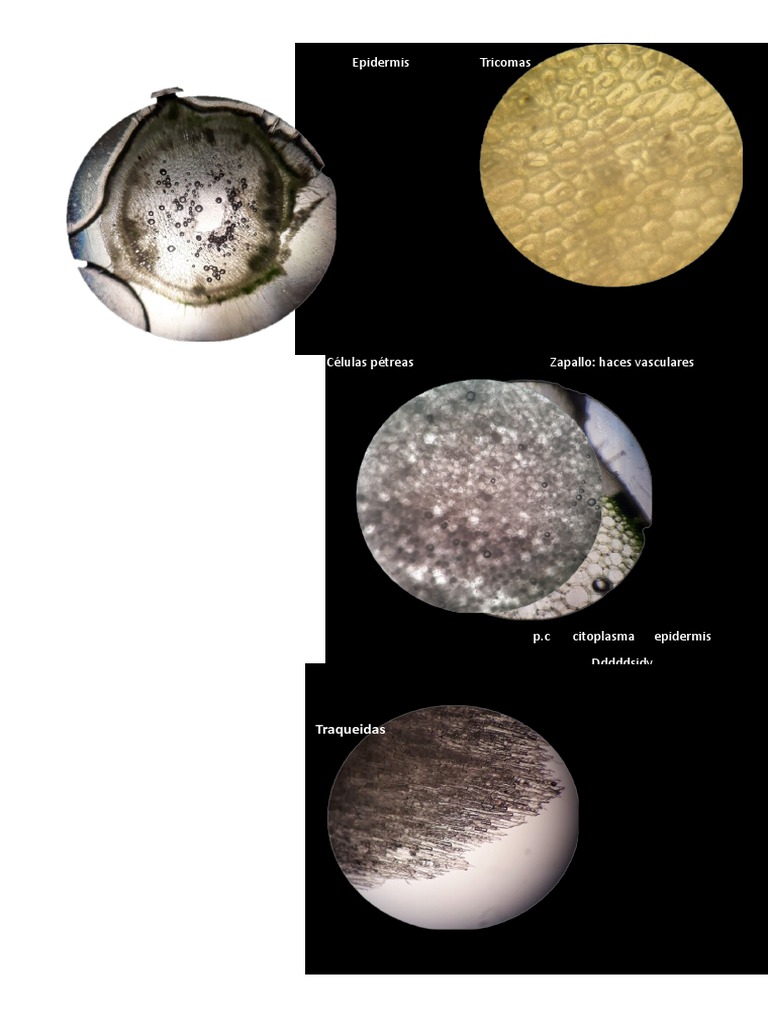 Epidermis Tricomas: Lum en Pared | PDF