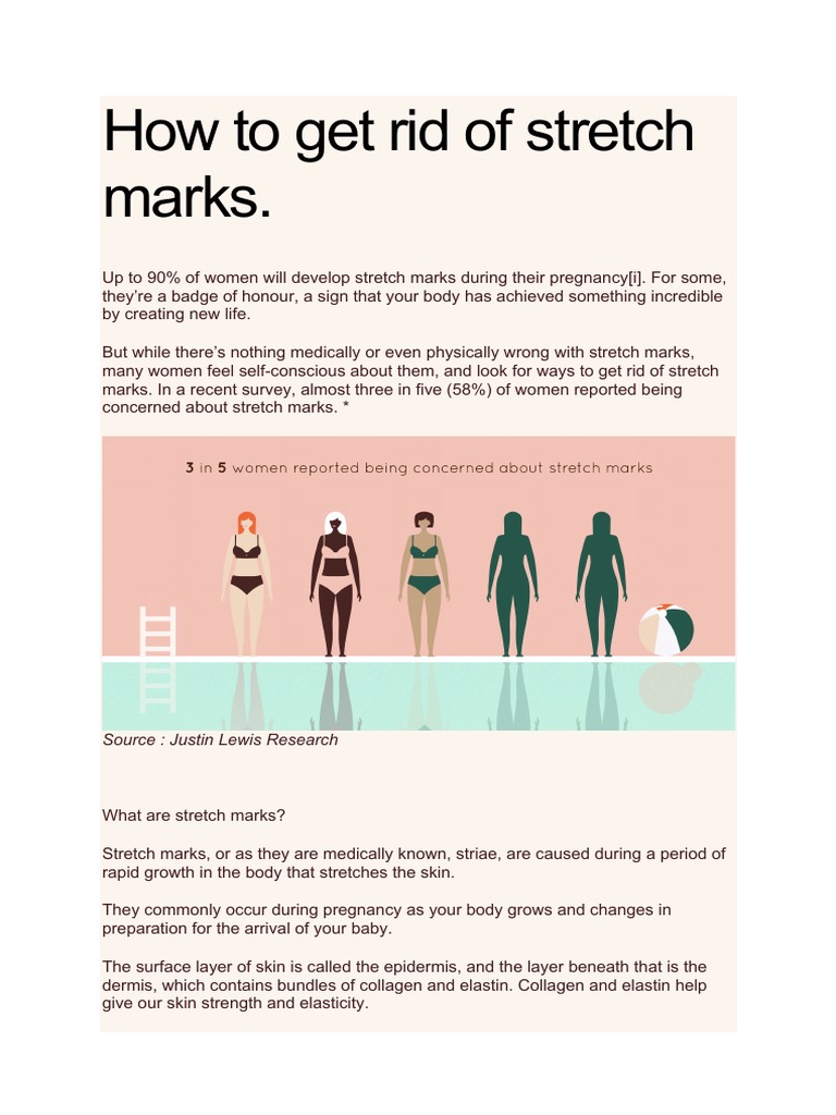 How To Get Rid of Stretch Marks | PDF | Skin | Medical Specialties