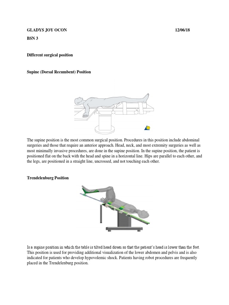 Trendelenburg Position For Shock