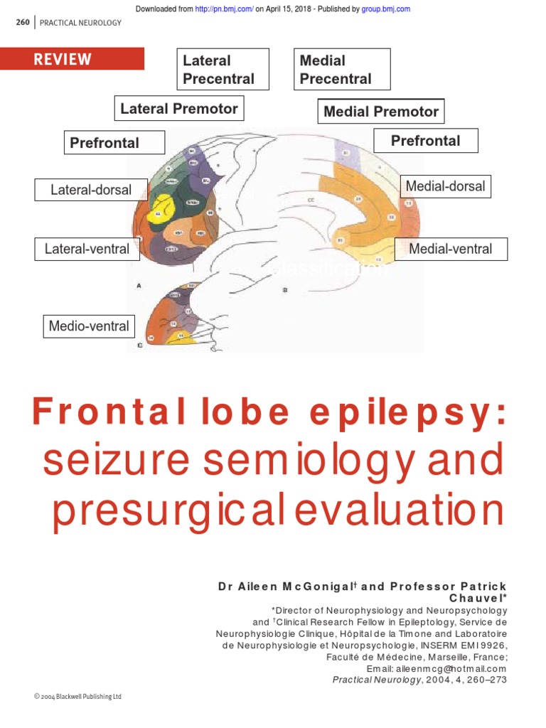 Frontal Lobe Epilepsy Epilepsy Electroencephalography