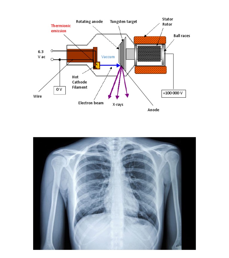 Rotating Anode Tungsten Target Stator Rotor Ball Races: Thermionic ...