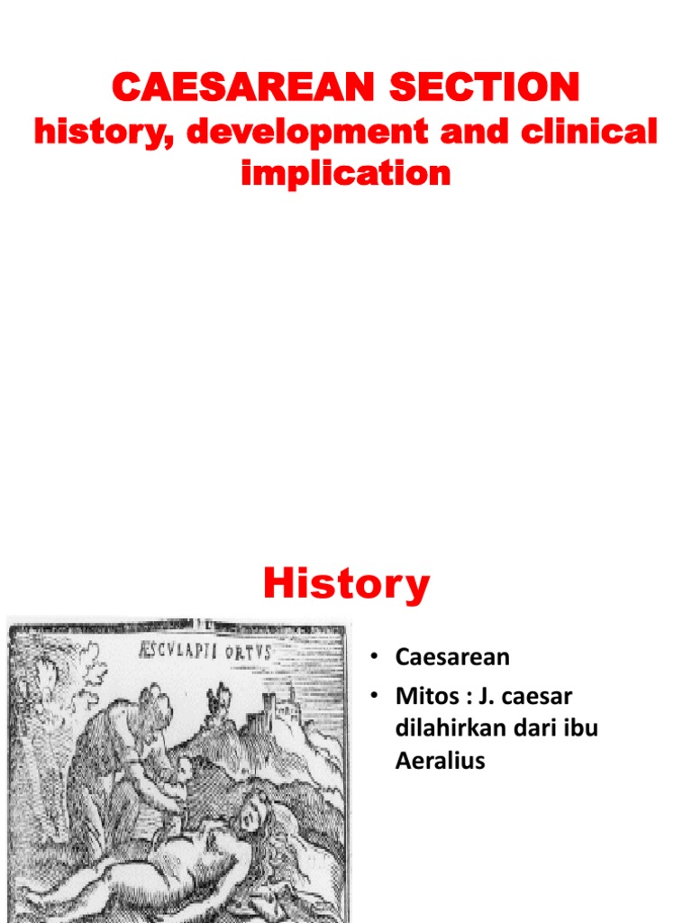 Caesarean Section: History, Development and Clinical Implication | PDF ...