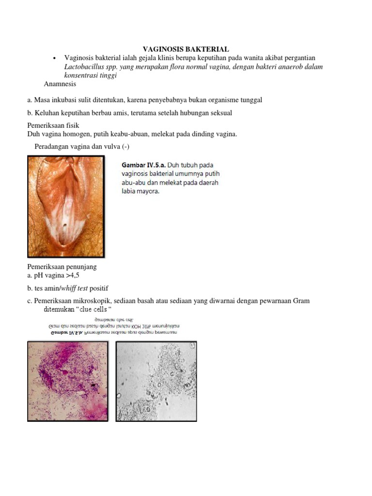 Vaginosis Bakterial | PDF
