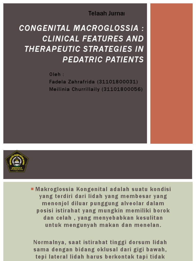 Congenital Macroglossia | PDF