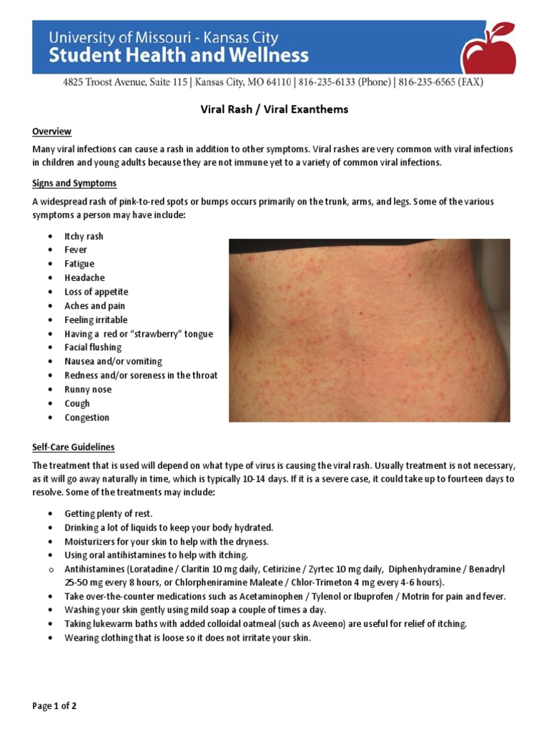 Viral Rash Guide: Causes, Symptoms & Home Treatments | PDF | Fever | Pain