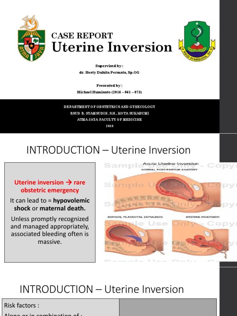 Case Report Uterine Inversion | PDF | Uterus | Postpartum Period
