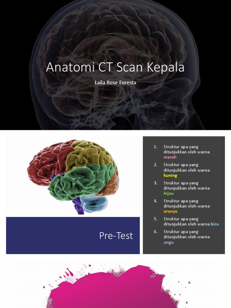 Brain CT Anatomy | PDF