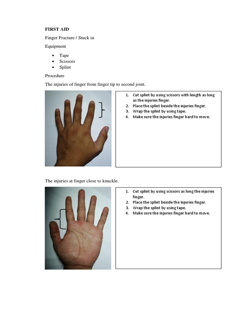 Finger Fracture / Stuck in Equipment Tape Scissors Splint Procedure The ...