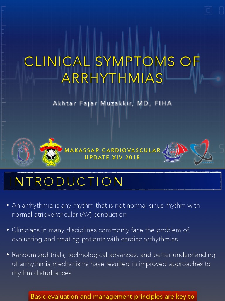 Workshop Symptoms of Arrhythmia (DR - Akhtar) - 1 | PDF | Internal Medicine | Heart