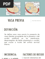 Distocia Funicular: Definición y Evaluación | PDF | Parto | Feto