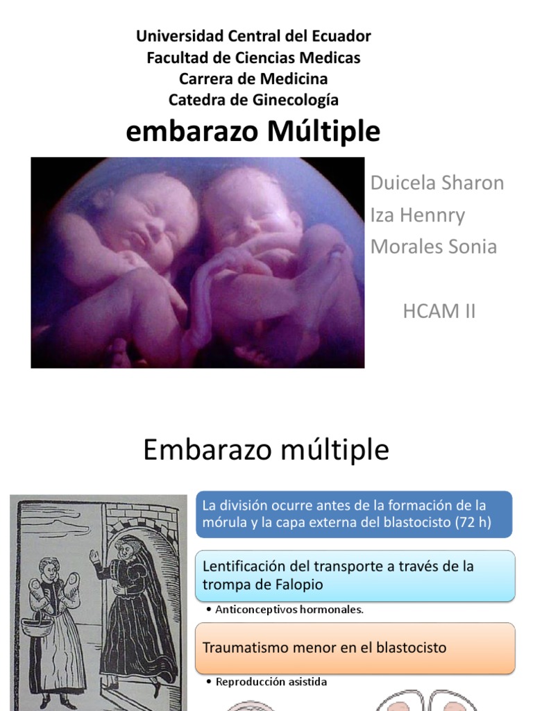 Embarazo Múltiple | PDF | Parto | El embarazo