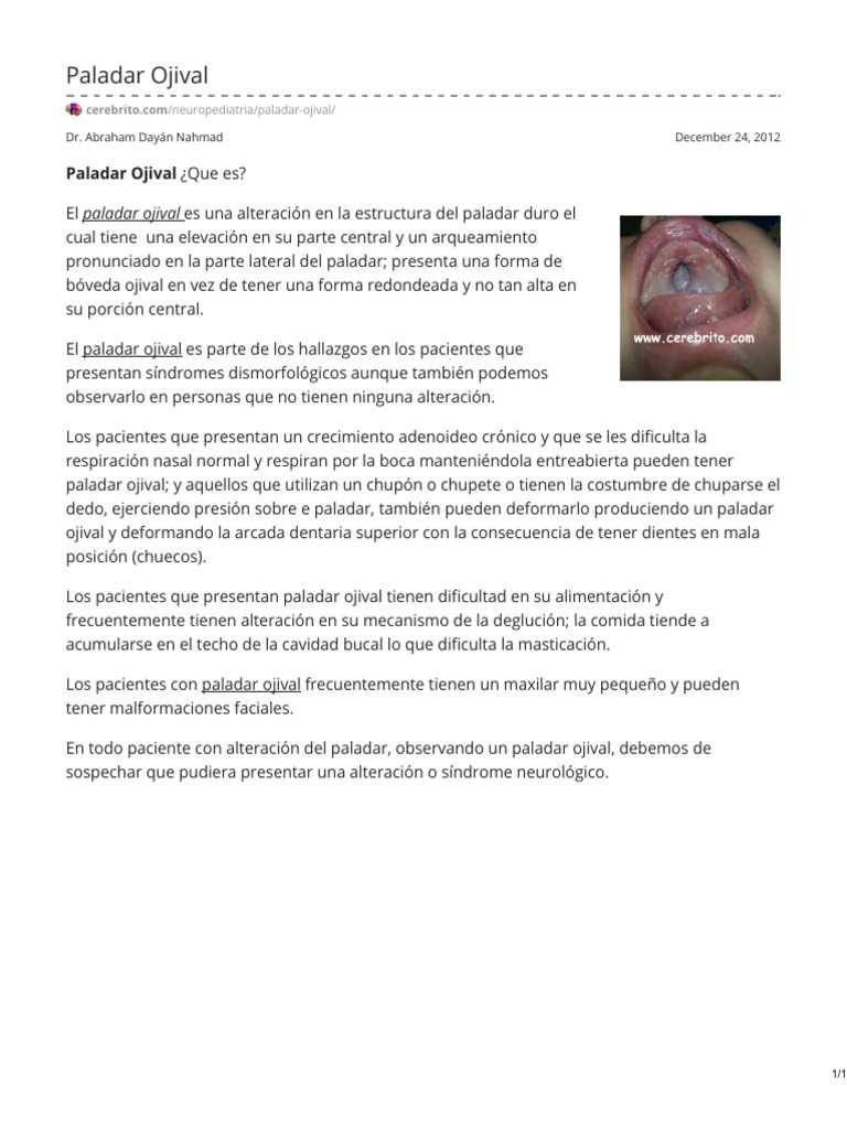 Paladar Ojival | PDF | Medicina CLINICA | Enfermedades y trastornos