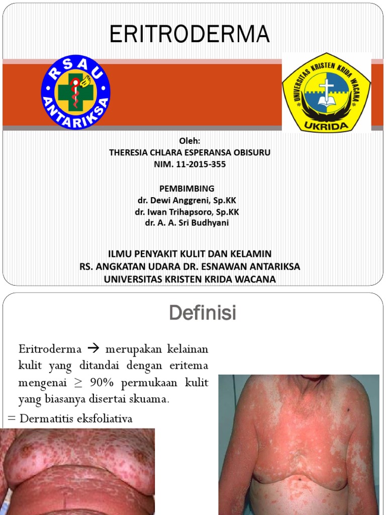 Eritroderma | PDF