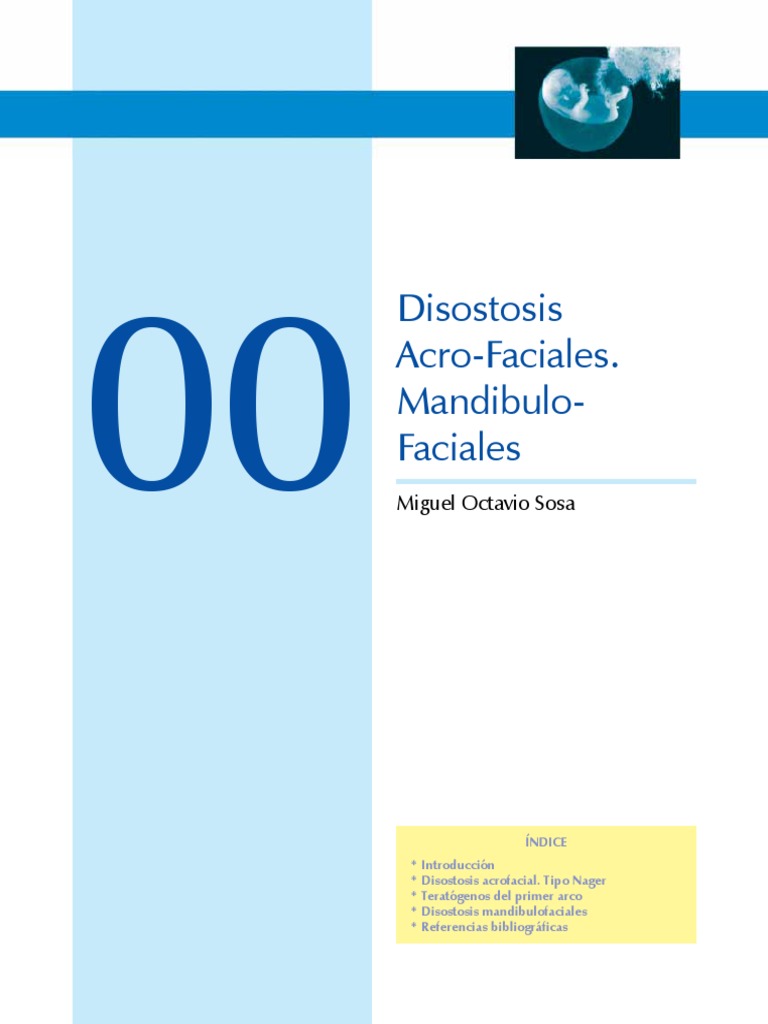 Disostosis Acrofacial: Síndrome de Nager | PDF | Dominancia (Genética ...
