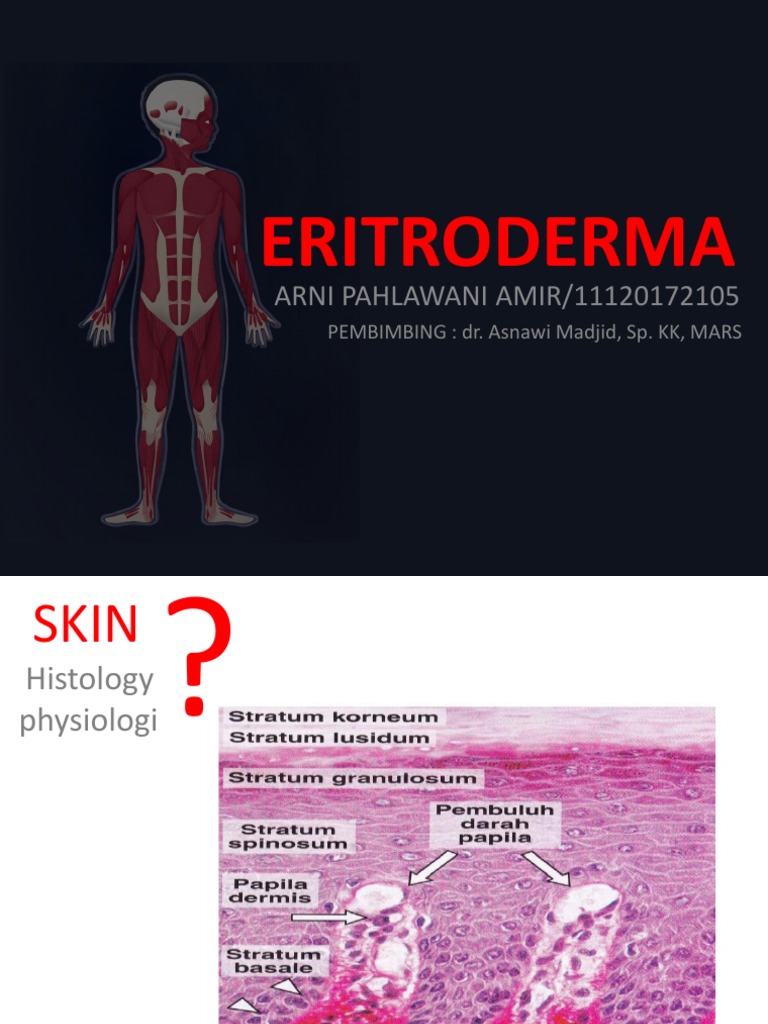 Eritroderma | PDF