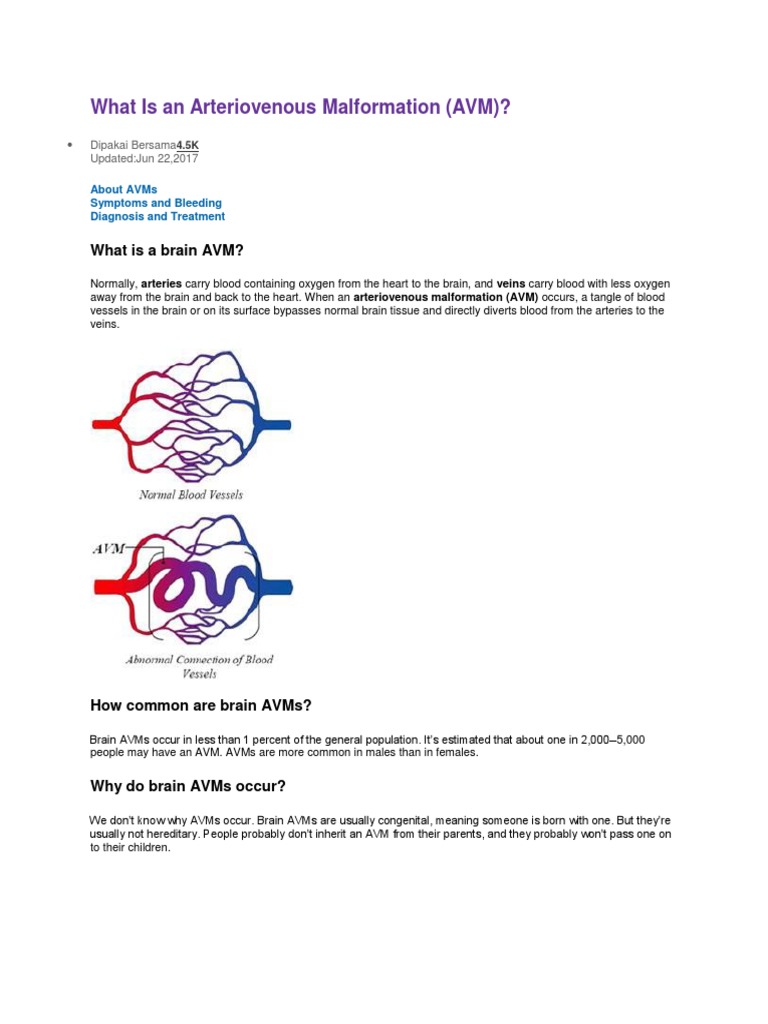 What Is An Arteriovenous Malformation (AVM) ? | PDF | Neurosurgery ...