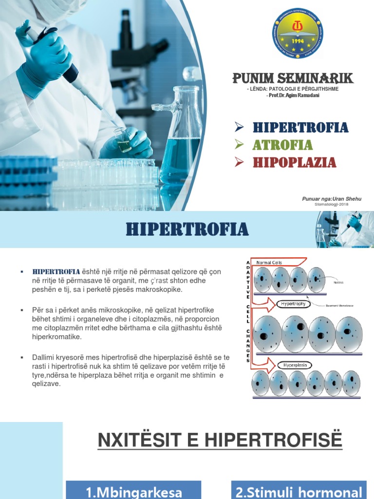 Hipertrofia Atrofia Hiperplazia | PDF