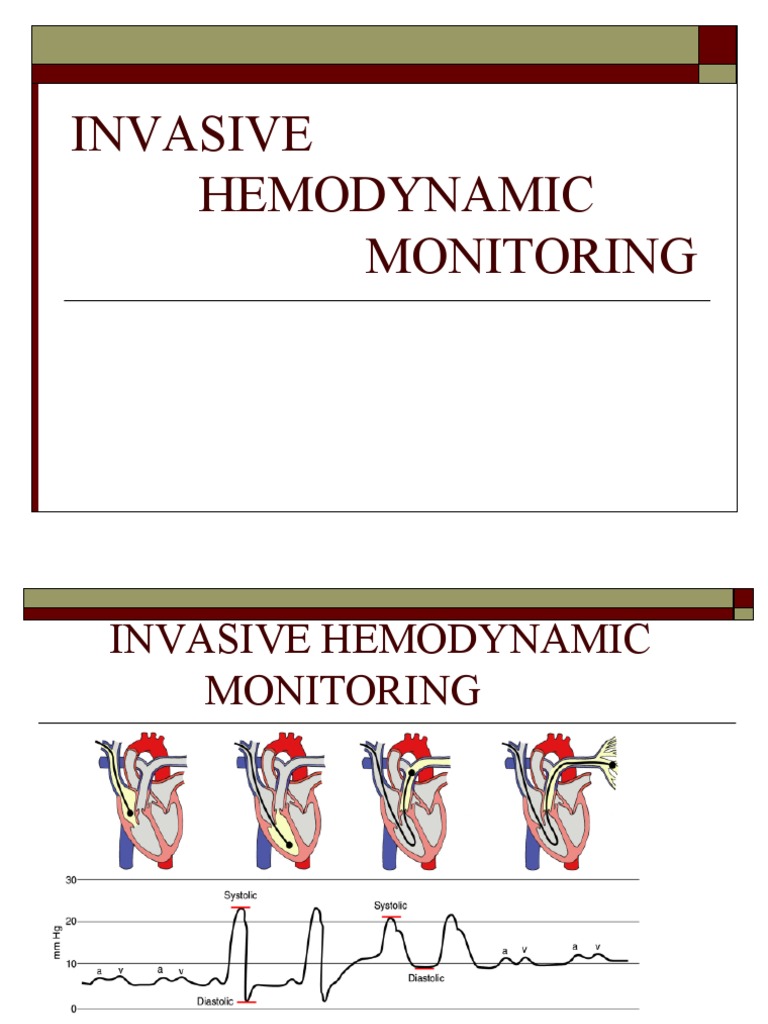 Invasive Hemodynamic Monitoring | PDF | Heart | Ventricle (Heart)