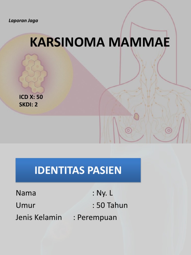 CA Mamae Dengan Efusi Pleura | PDF
